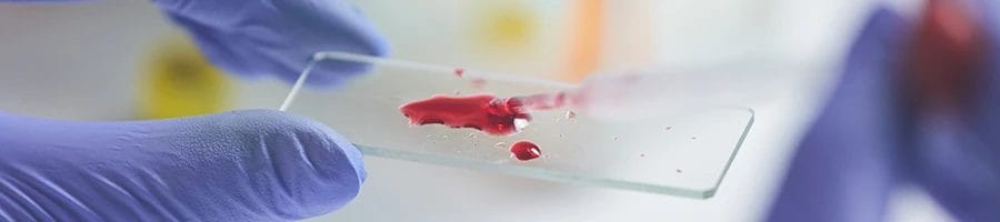 Do Drugs Show Up in Blood Tests? (6 Detection Factors)