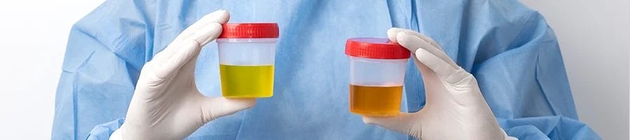 Quick Fix vs UPass (5 Significant Feature Comparisons)